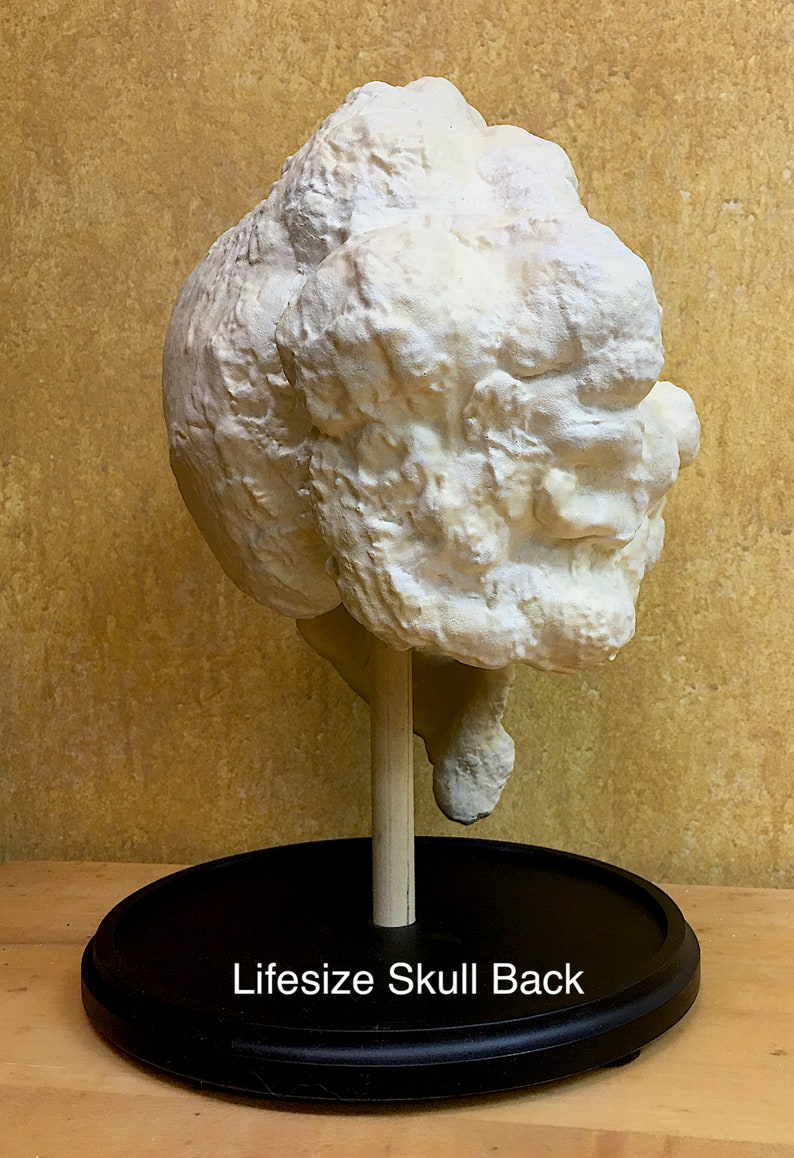 Joseph Merrick the Elephant Man Life-size Skull Reproduction - Etsy