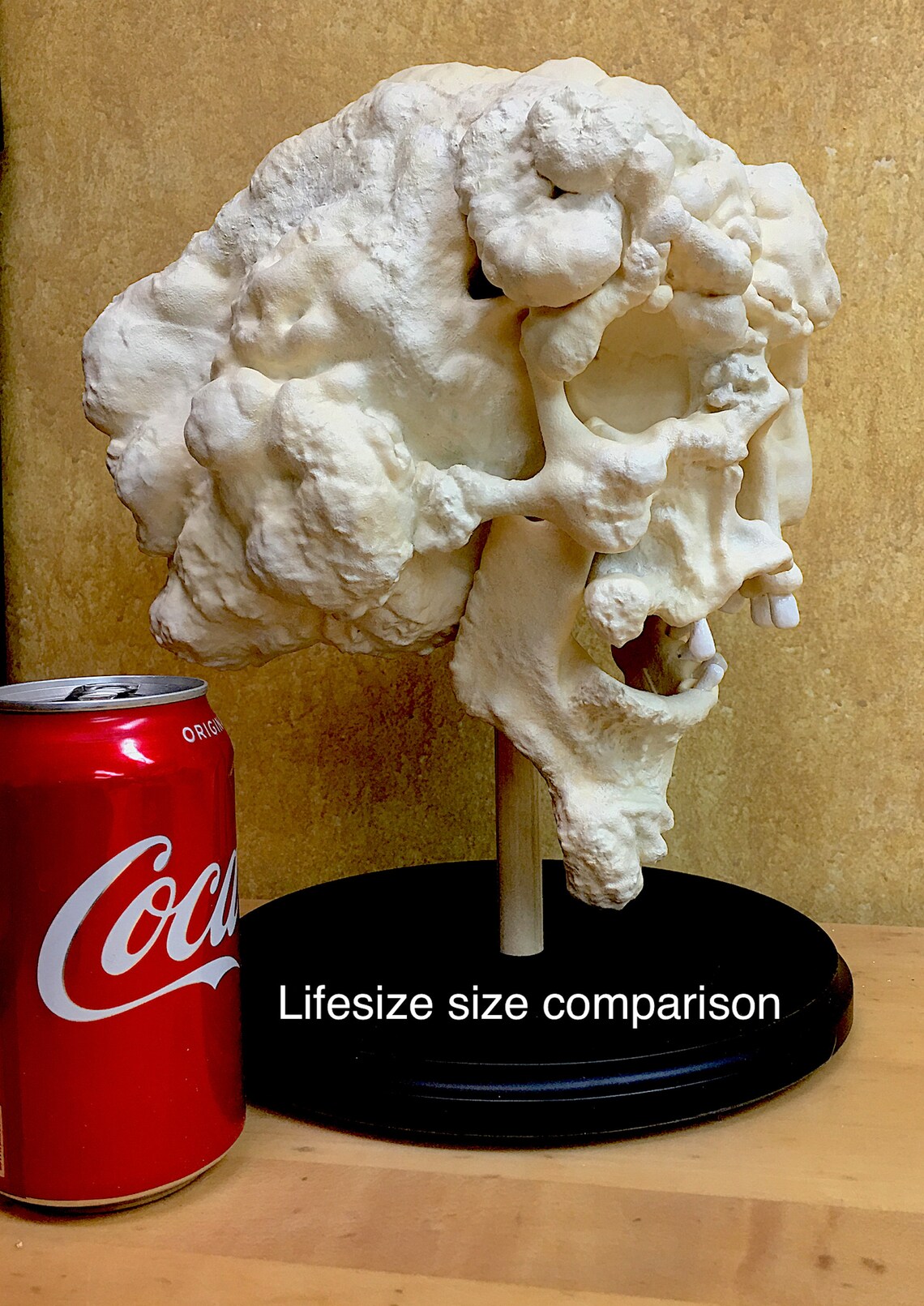 Joseph Merrick, the Elephant Man Life-size Skull Reproduction - Etsy