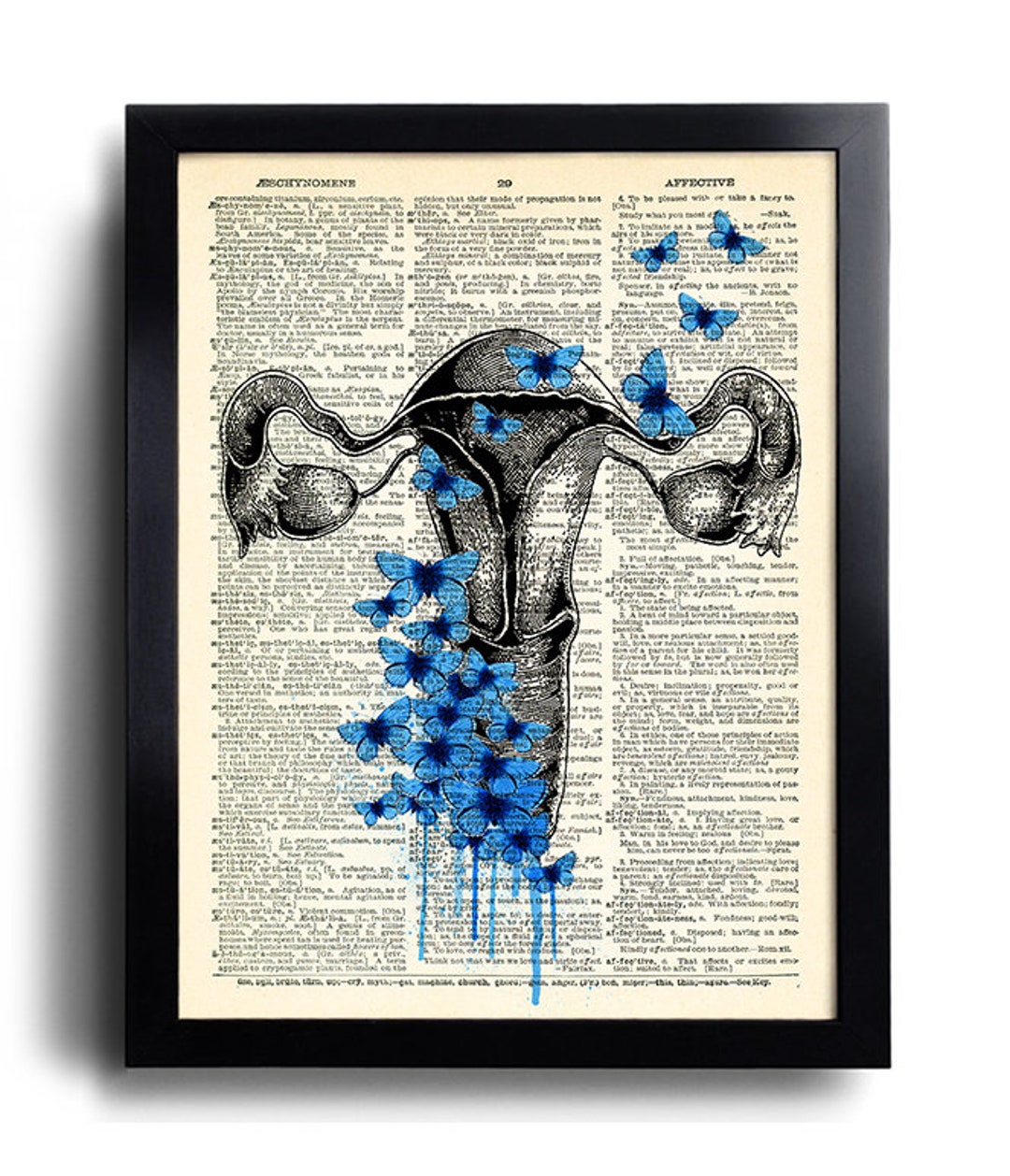Uterus Poster Pregnancy Gift Uterus Print Female Reproductive System ...