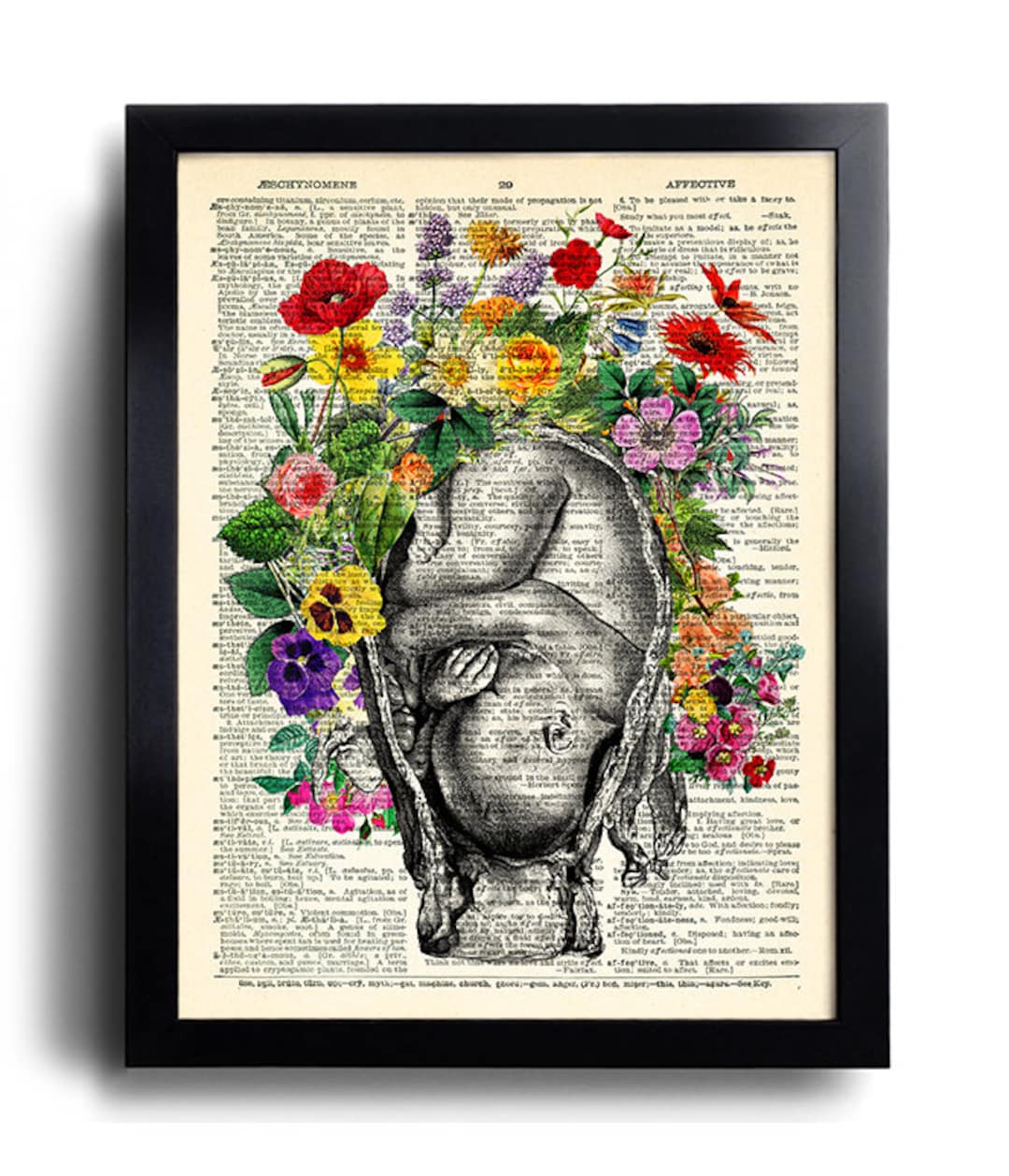 Fetus in Womb Print Embryo Print Pregnancy Gift Expecting Mom Gift ...