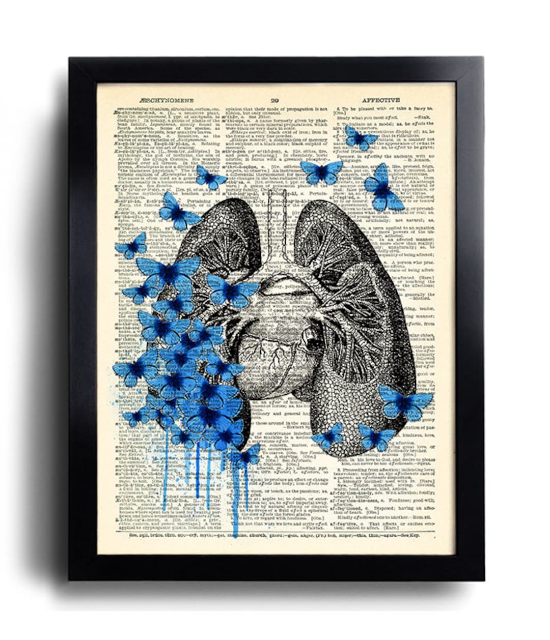 Lungs Print Anatomical Lungs Poster Lung Decor Human Anatomy Art Doctor ...