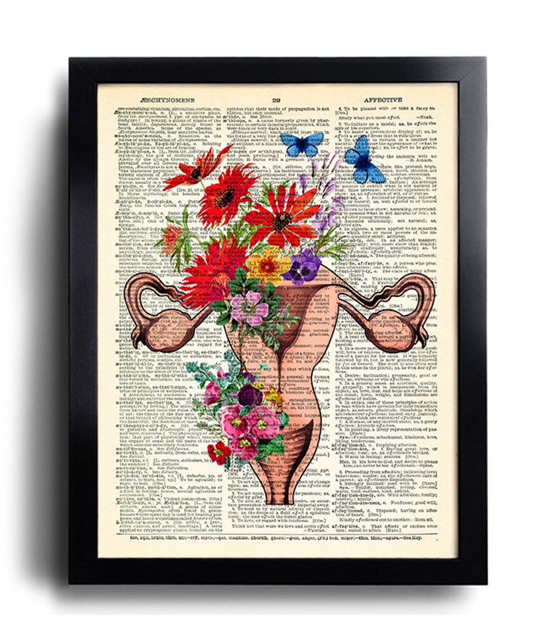 Uterus Print Uterus Poster Pregnancy Gift Ovaries Art Womb Women Gift ...
