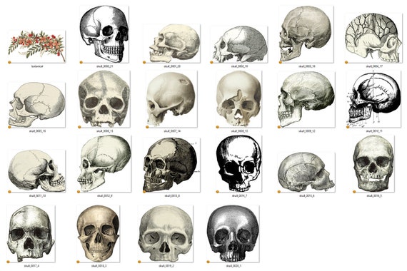 Types Of Human Skulls