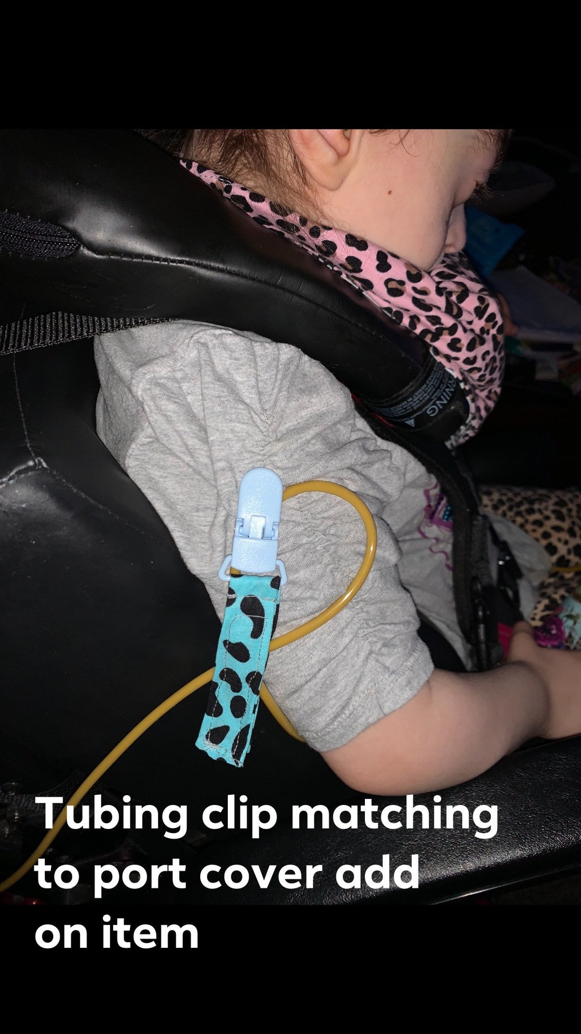 1 GTube Feeding Tube Port Cover Clip On Feeding Pump | Etsy