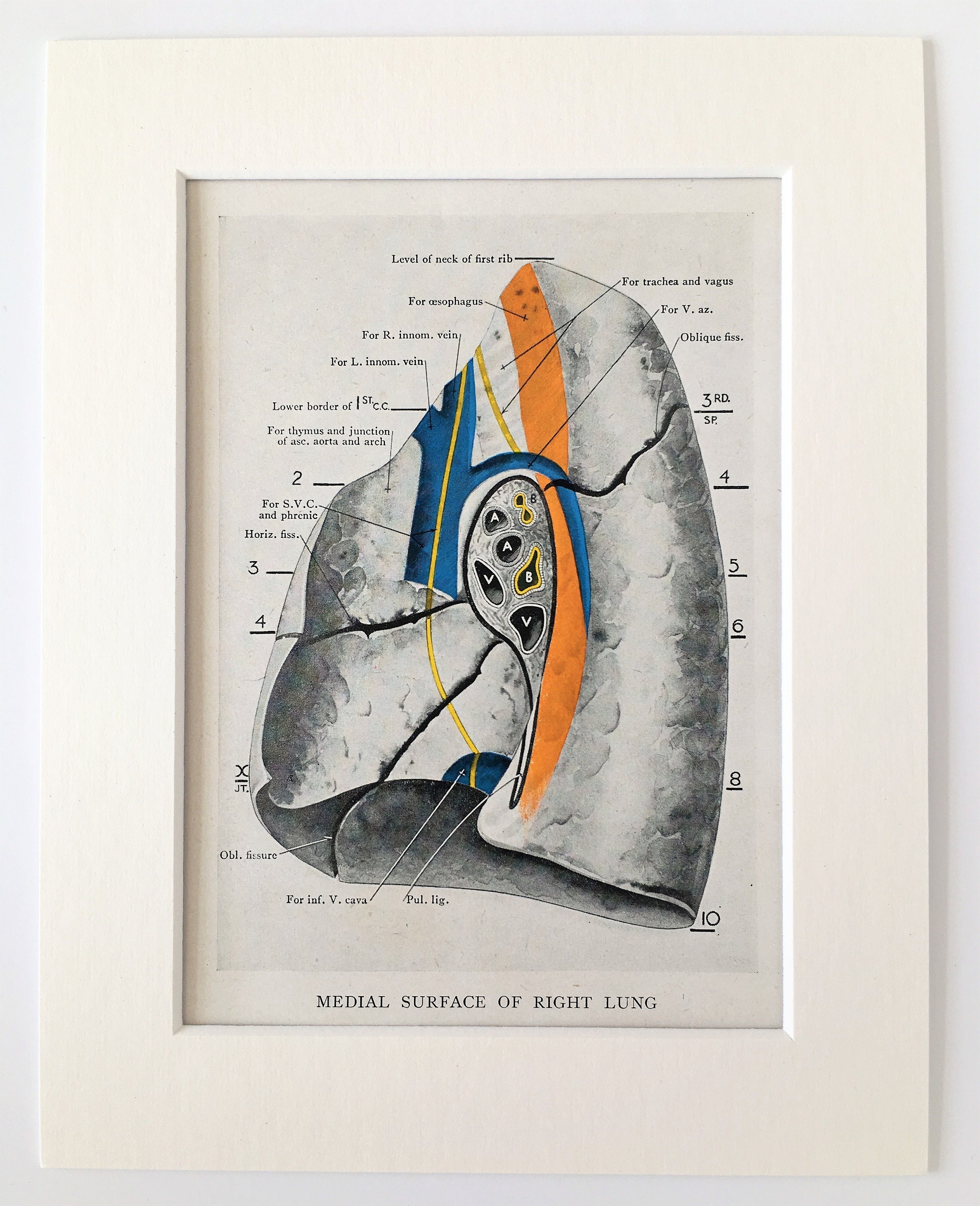 Medial Surface Of Lung 1930s Vintage Anatomy Print Colour Etsy
