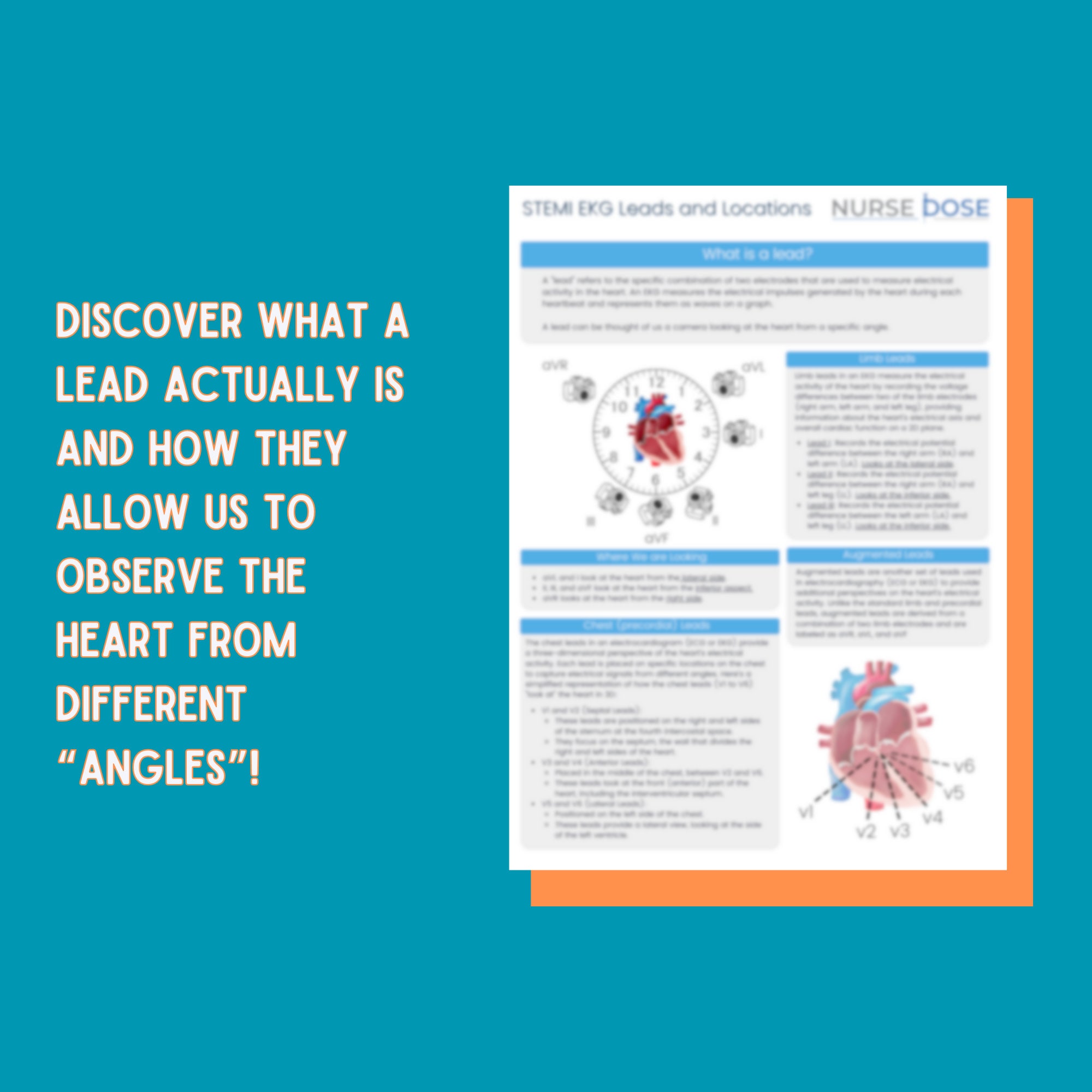 Cardiac Nursing Notes STEMI Leads & CCRN Study Guide CVICU Cheat Sheet ...