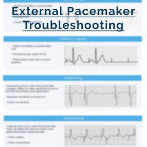 Printable External Pacemaker Cheat Sheet Digital Download | Cardiac ...