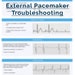 Printable External Pacemaker Cheat Sheet Digital Download Cardiac Nurse ...