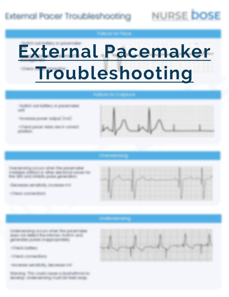 External Pacemaker Cheat Sheet Digital Download Cardiac - Etsy