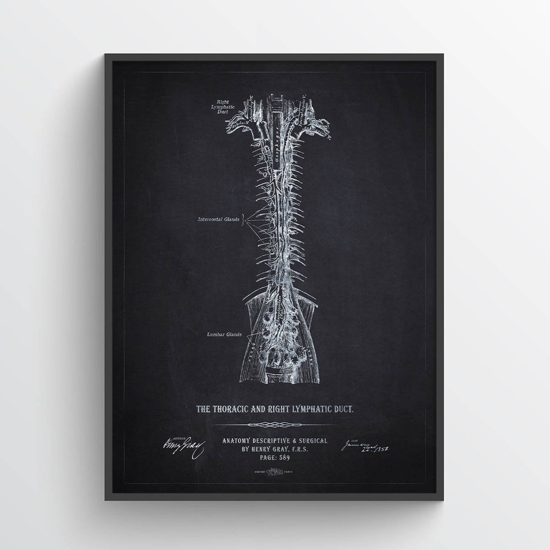 Lymphatics Anatomy Print, Endocrinology Art, Medical Office Decor ...
