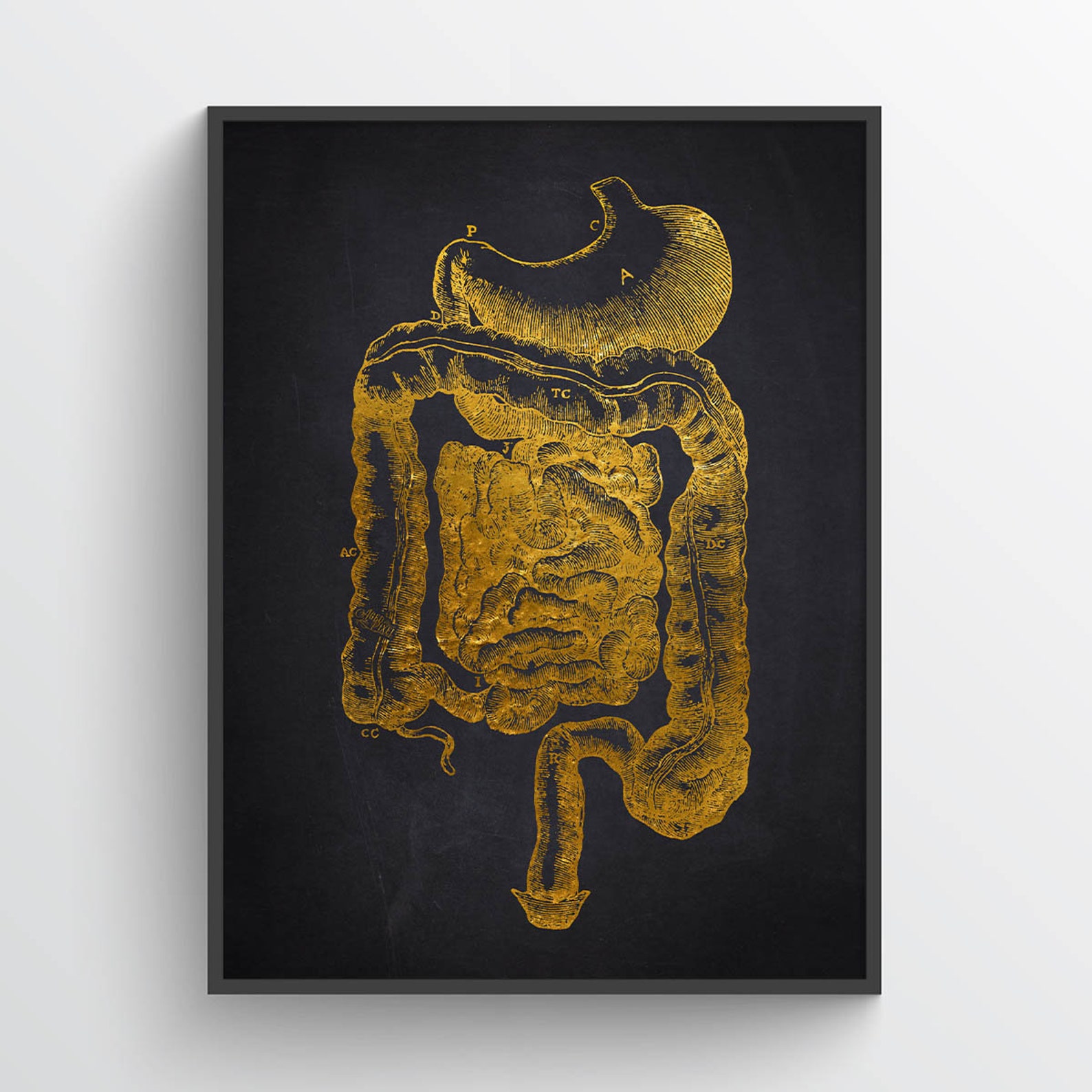 Digestive Tract Anatomy Print, Intestine, Stomach Art, Medical Office ...