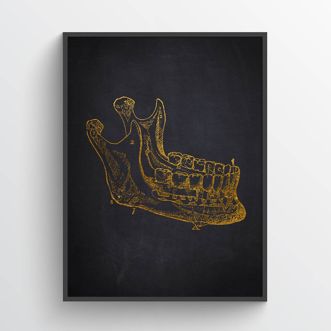 Body of the Lower Jaw Anatomy Print, Dentist Gift, Dental Office Poster ...