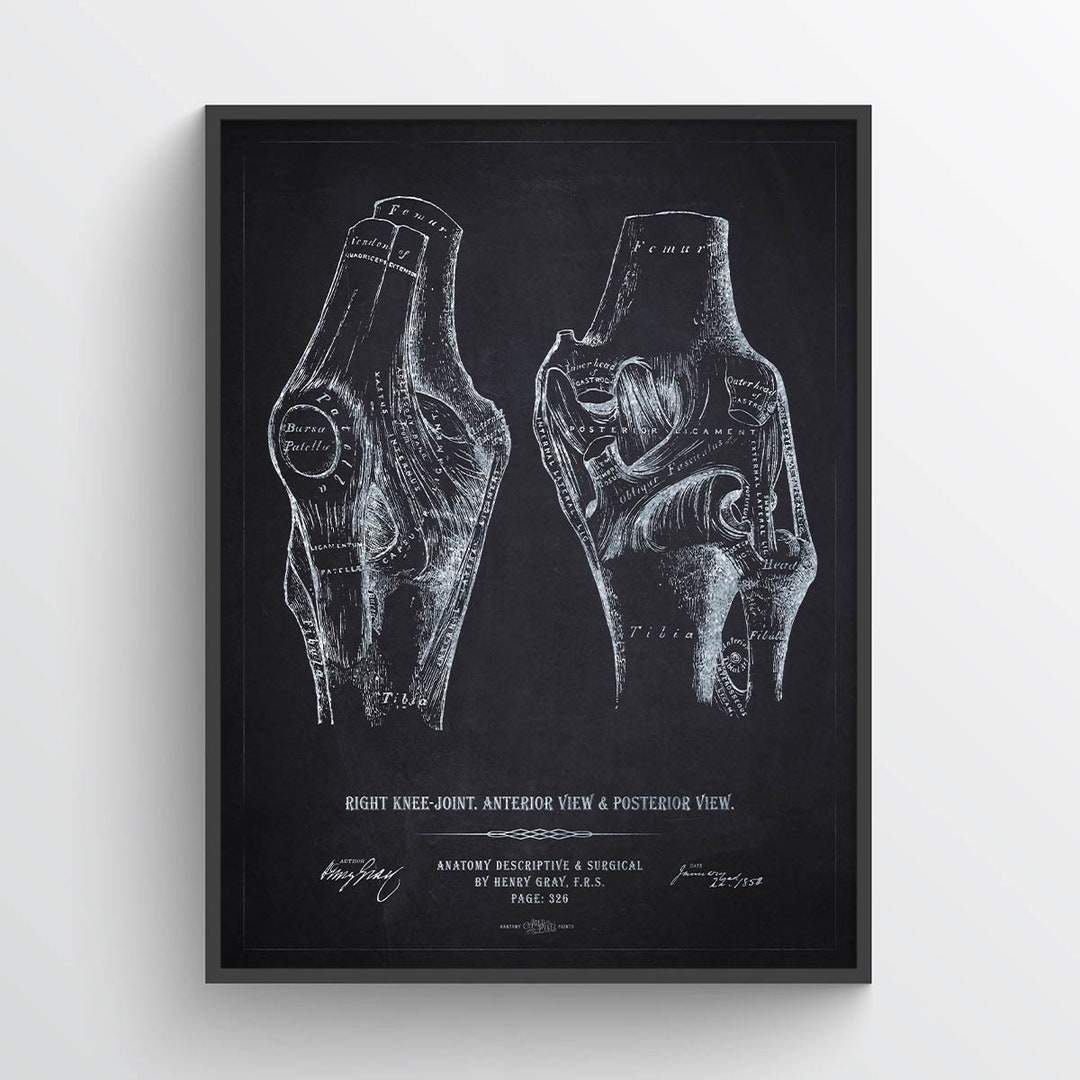 Knee Joint Anatomy Print, Gift for Orthopedic Surgeon, Orthopedists ...