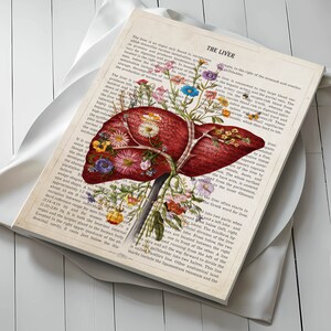 Liver Anatomy Print, Gastroenterologist Gift, Liver Transplant, Liver ...