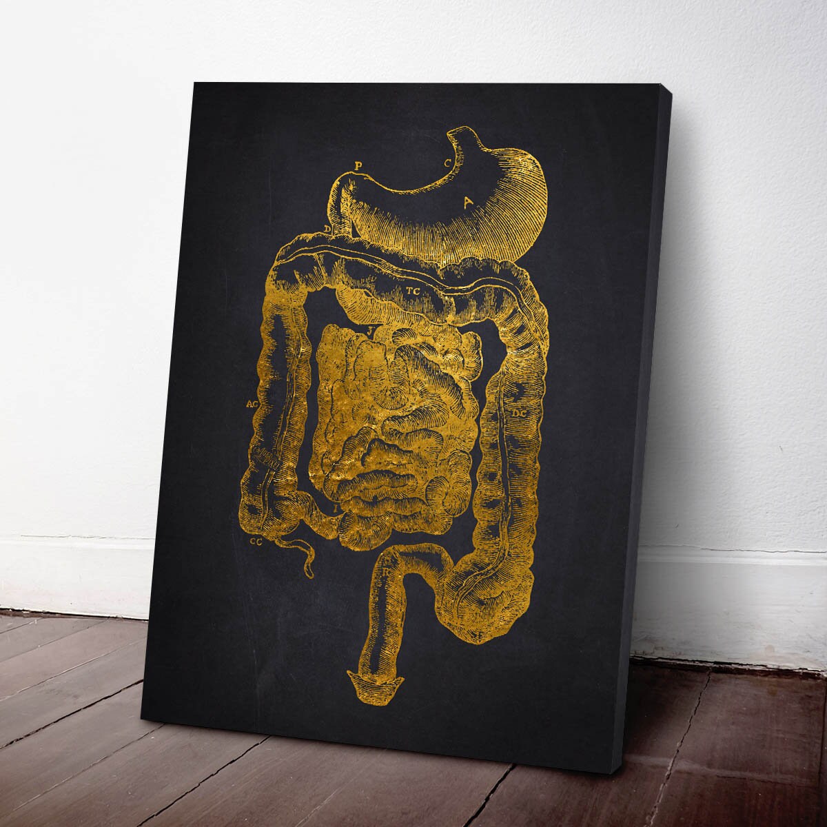 Digestive Tract Anatomy Print, Intestine, Stomach Art, Medical Office ...