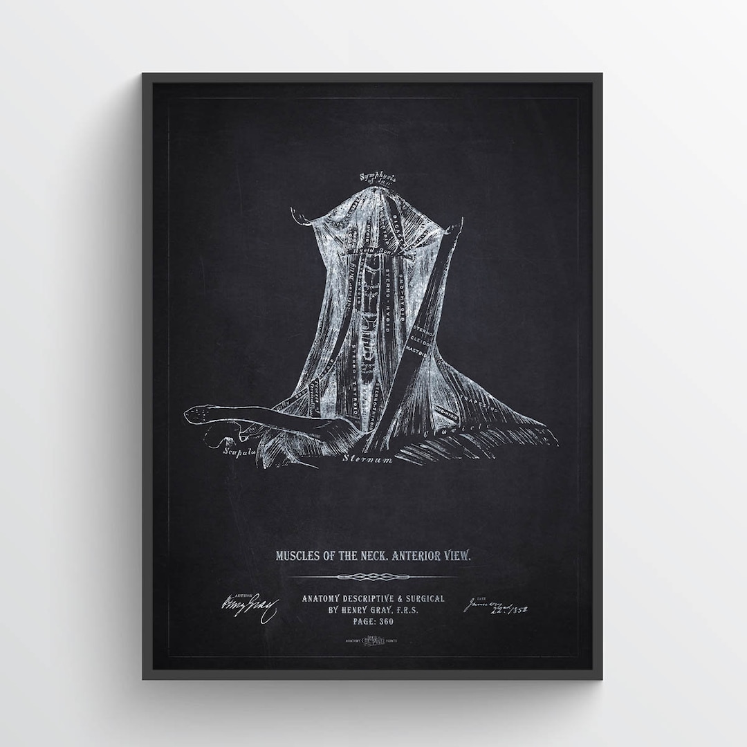 Muscles of the Neck Anatomy Print, Neck Muscles, Physical Therapy Art ...