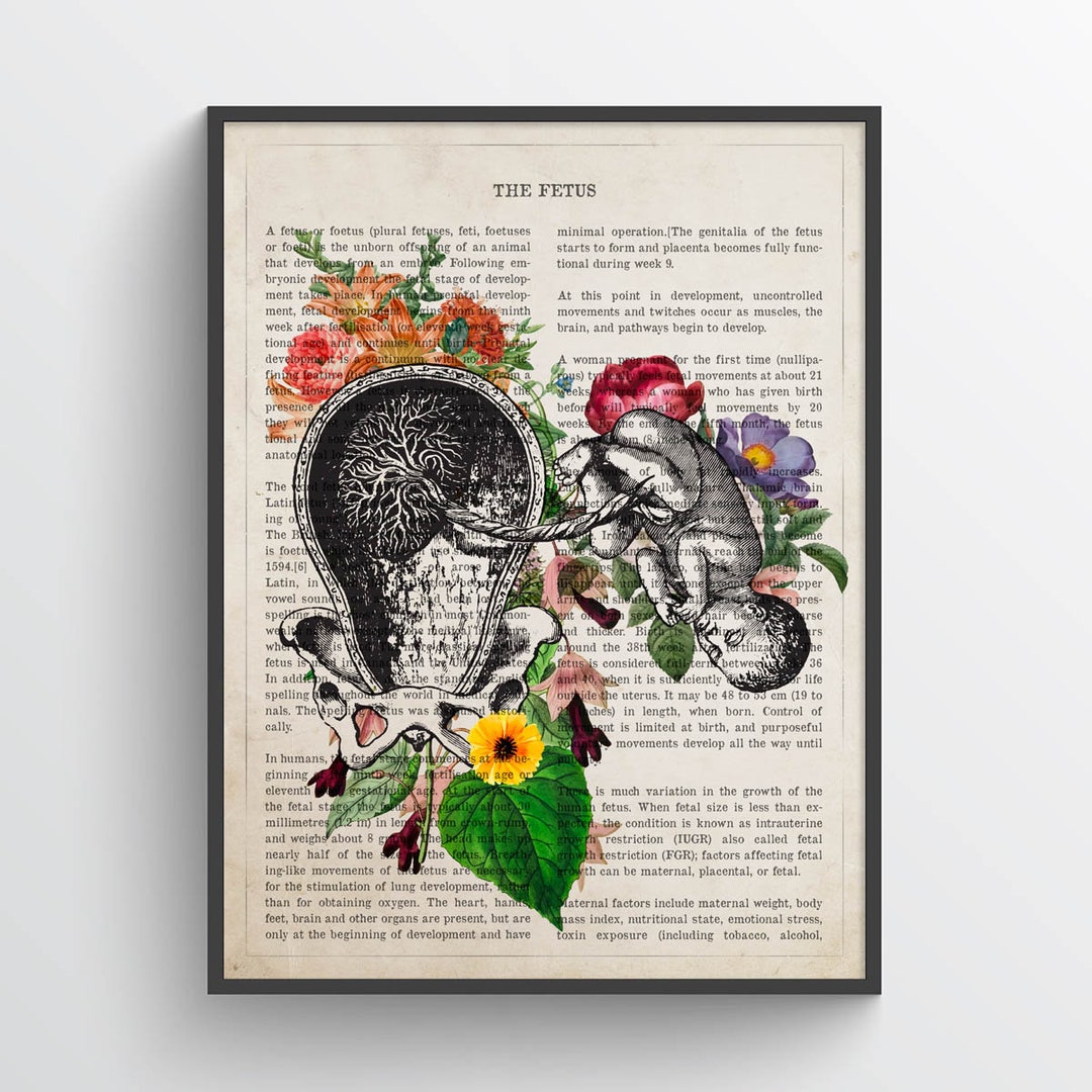 Womb and Fetus Flower Anatomy Print, Obstetrician Graduation Gift Idea ...