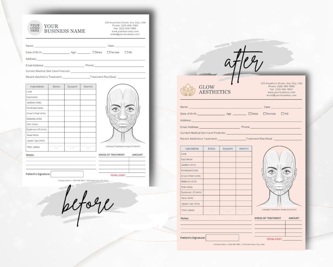 Botox Treatment Form Editable Template: Client Consent Record, Medspa ...