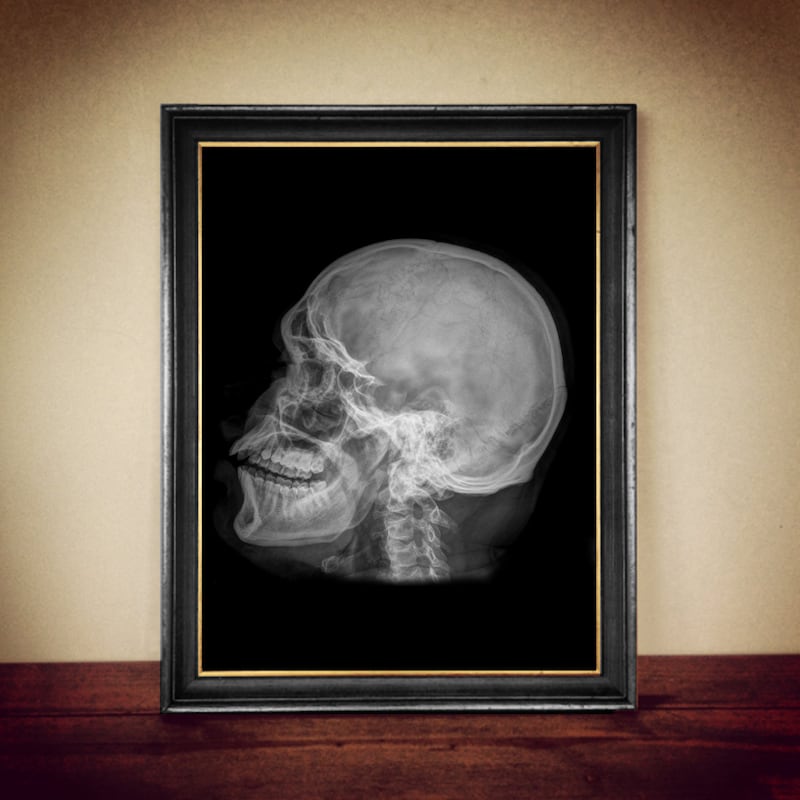 Xray Art - Etsy