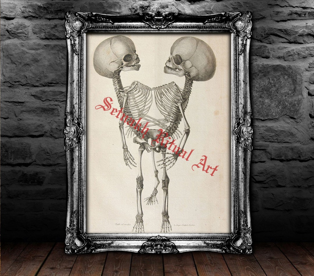 Vintage Occult Print, Siamese Skeleton Poster, Victorian Macabre ...