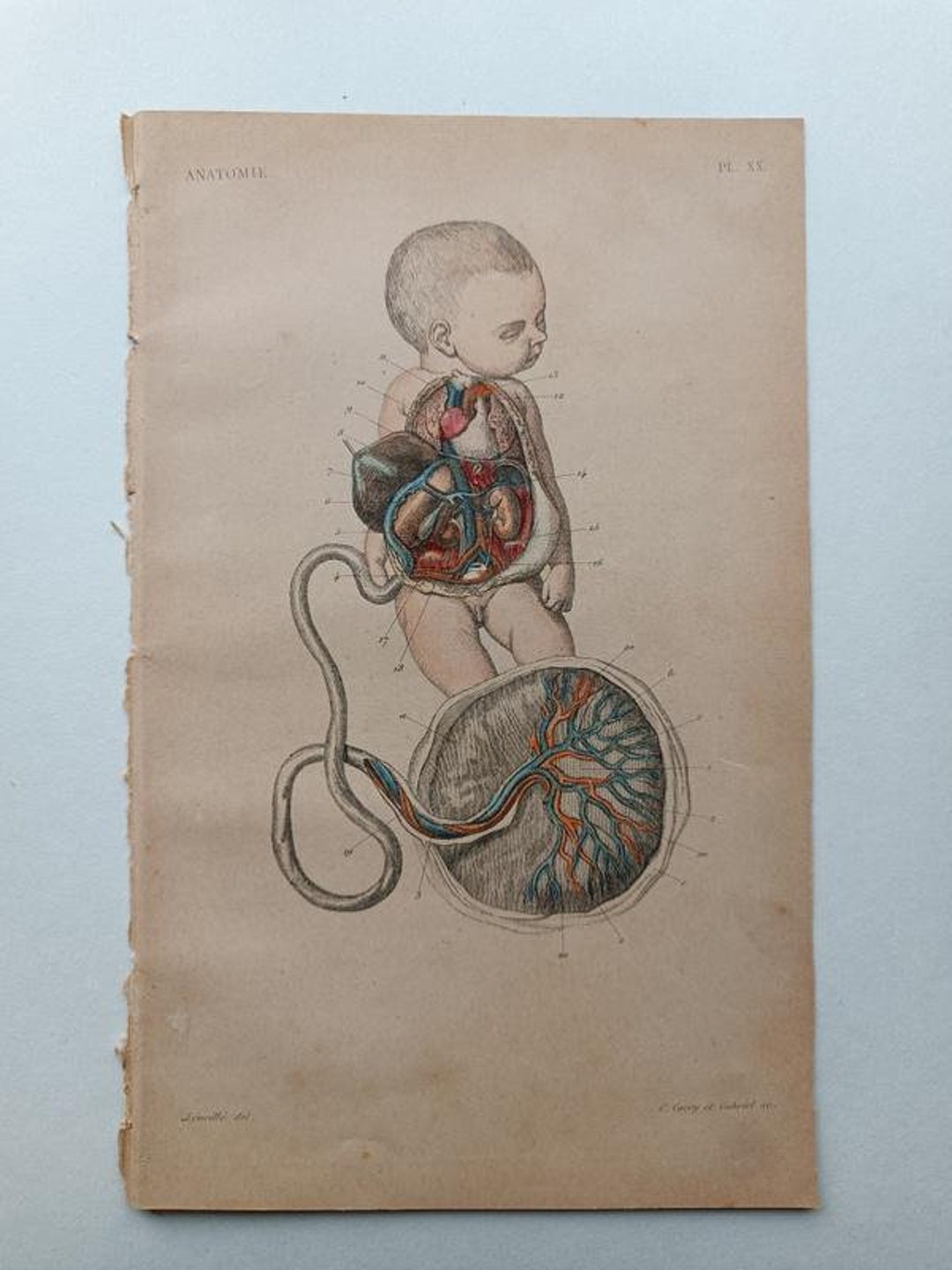 1873 Antique FETUS ANATOMY Engraving Original Antique Print Medical ...