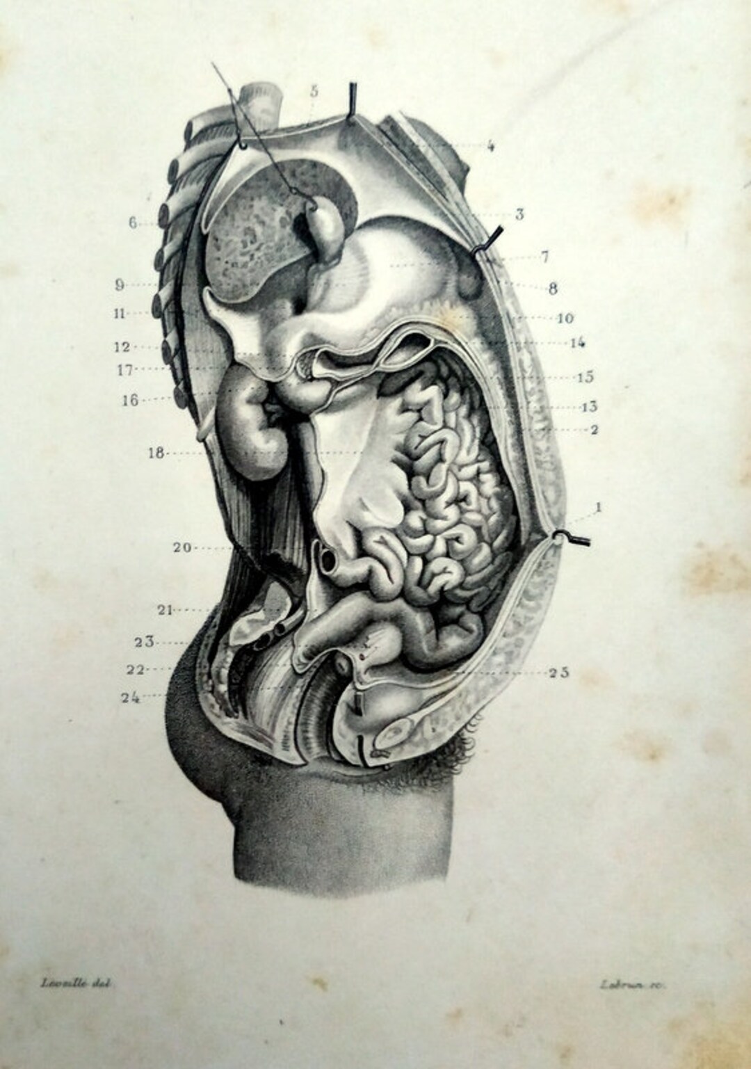 1846 Antique Anatomy Peritoneum Print, Vintage Engraving of Internal ...