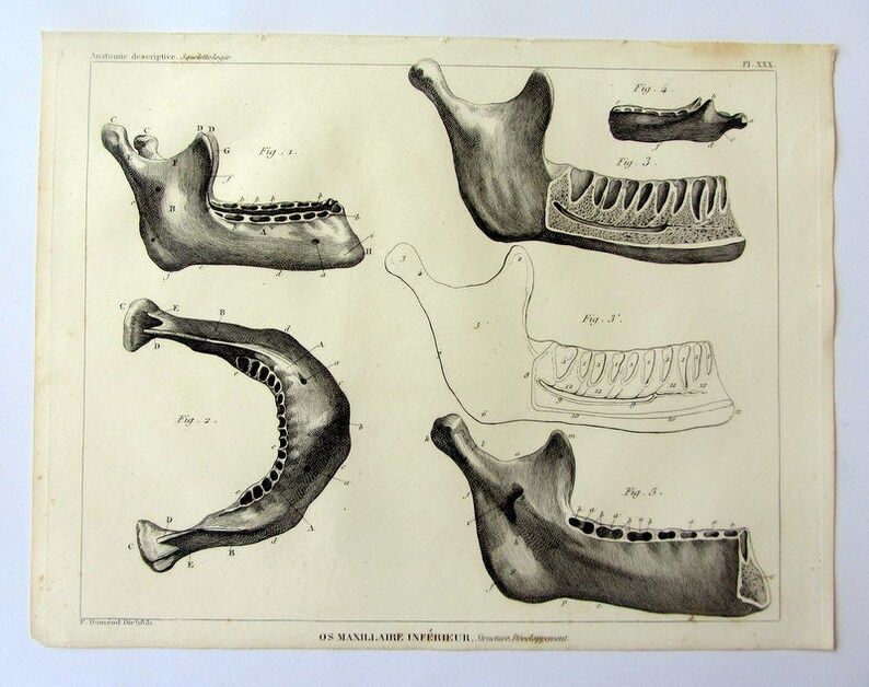 Antique Dental Inferior Maxilla Anatomy Engraving, Print of Human Body ...