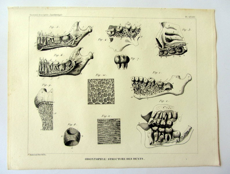 Print of Structure of Teeth, Anatomy BONES MOUTH Engraving, 1831 ...