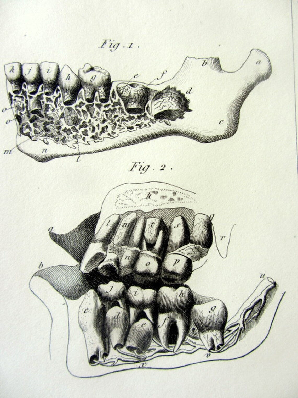 Print of Structure of Teeth, Anatomy BONES MOUTH Engraving, 1831 ...
