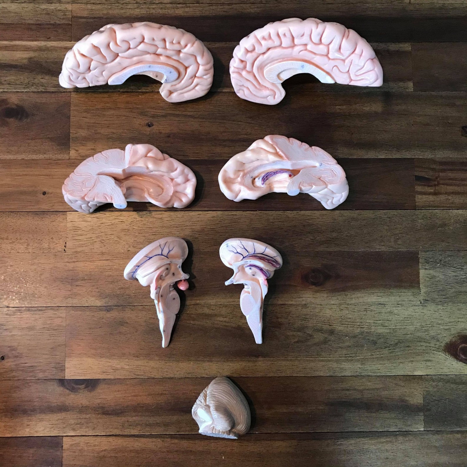 Vintage SOMSO Human Brain Anatomical Model 8 Parts | Etsy