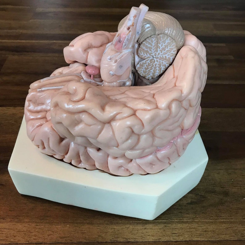 Vintage SOMSO Human Brain Anatomical Model - 7 Parts - Etsy