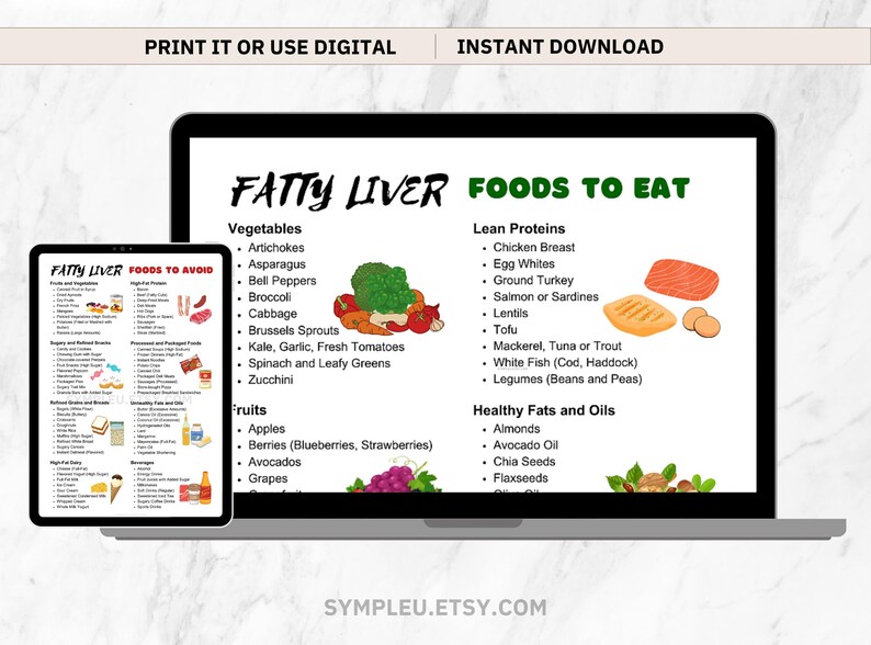 Fatty Liver Diet Food List for Fatty Liver Food Chart, Fatty Liver ...