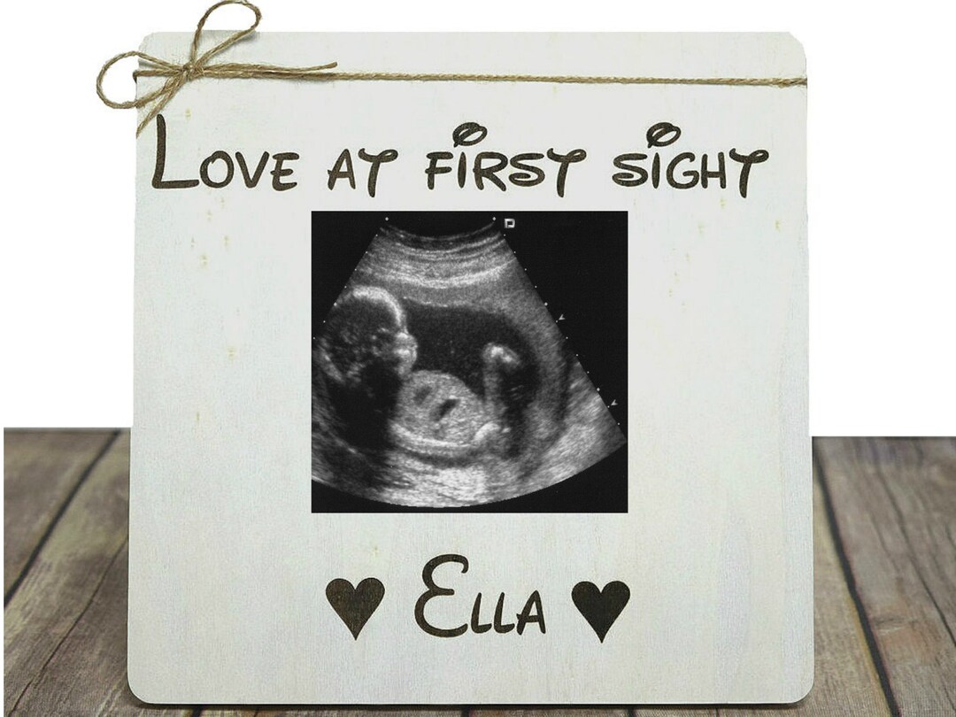 Ultrasound Frame Sonogram Frame Gender Reveal New Baby - Etsy