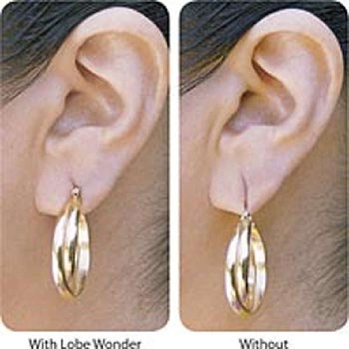 LOBE WONDER Earring Support Patches for Damaged; Stretched; and Torn ...