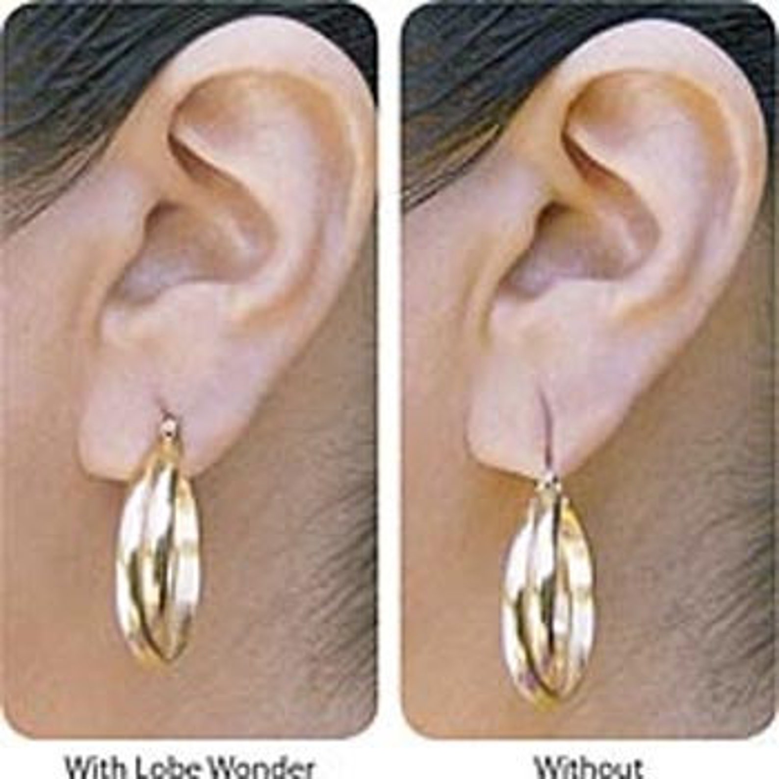 LOBE WONDER Earring Support Patches for Damaged; Stretched; and Torn ...