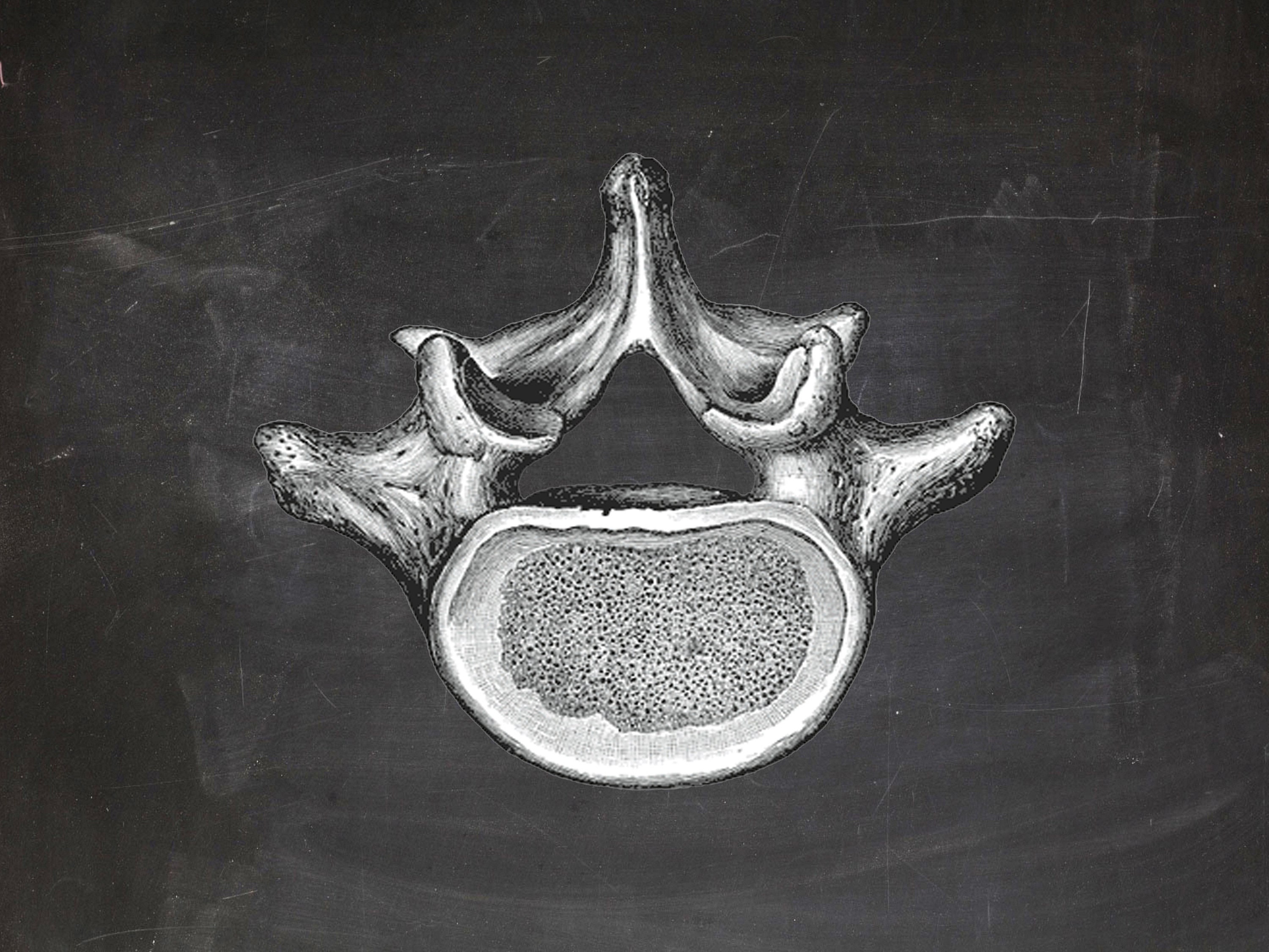 Chalkboard Chiropractic Definition and Spinal Display Wall Set