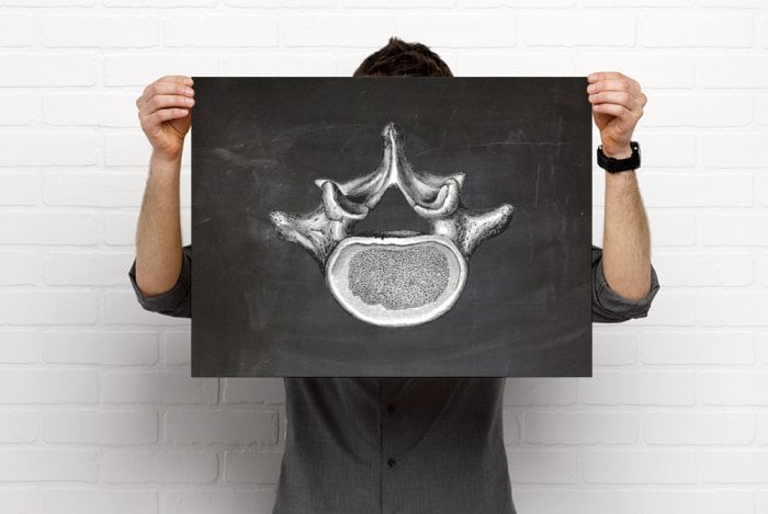 Chalkboard Chiropractic Definition and Spinal Display Wall Set