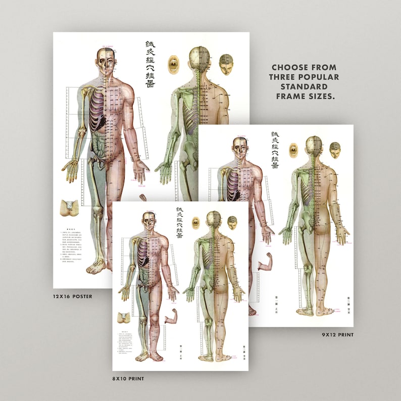 Acupuncture Chart Print • Choose From 5 Sizes! • Vintage Acupuncture ...