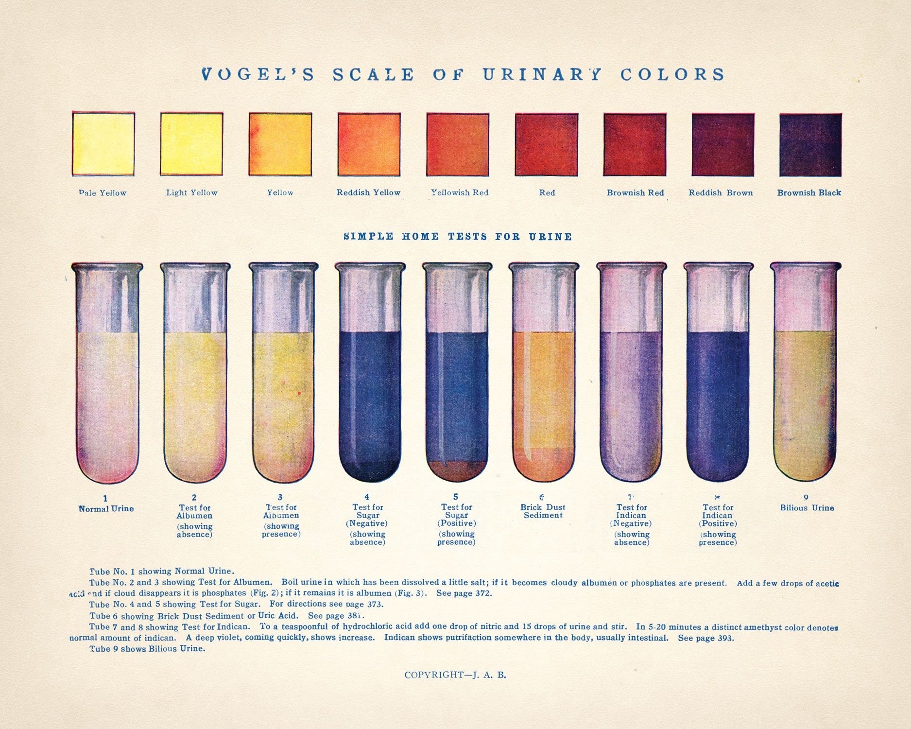 Antique Urine Chart • 4 Sizes! • High Quality Giclee Print • Bathroom ...