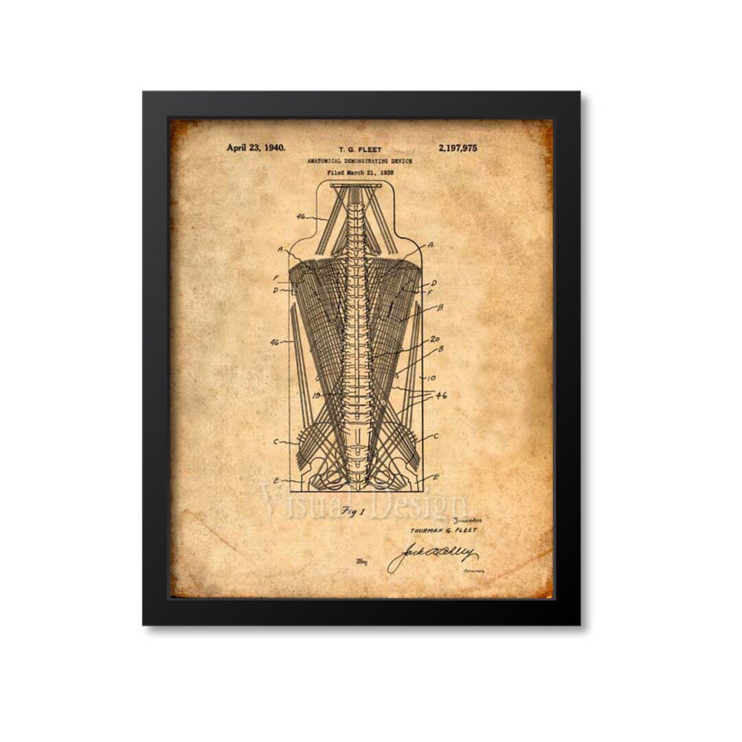 Spine Anatomical Skeleton Patent Print Chiropractor Gift - Etsy