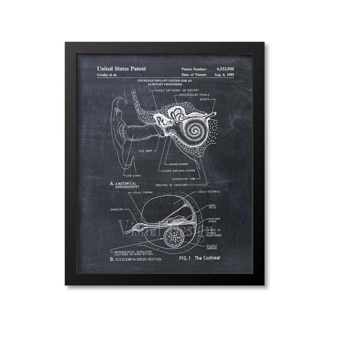 Hearing Implant Patent Print, Doctor Art, Audiologist Gift, Surgeon ...