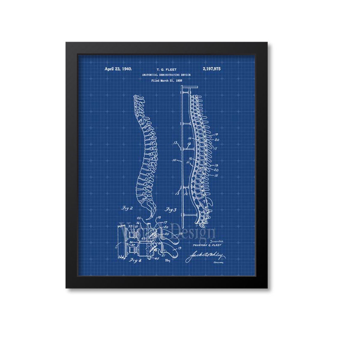 Spine Anatomical Skeleton Patent Print Spine Skeleton Art - Etsy