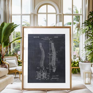 Spine Anatomical Skeleton Patent Print Spine Skeleton Art Print - Etsy