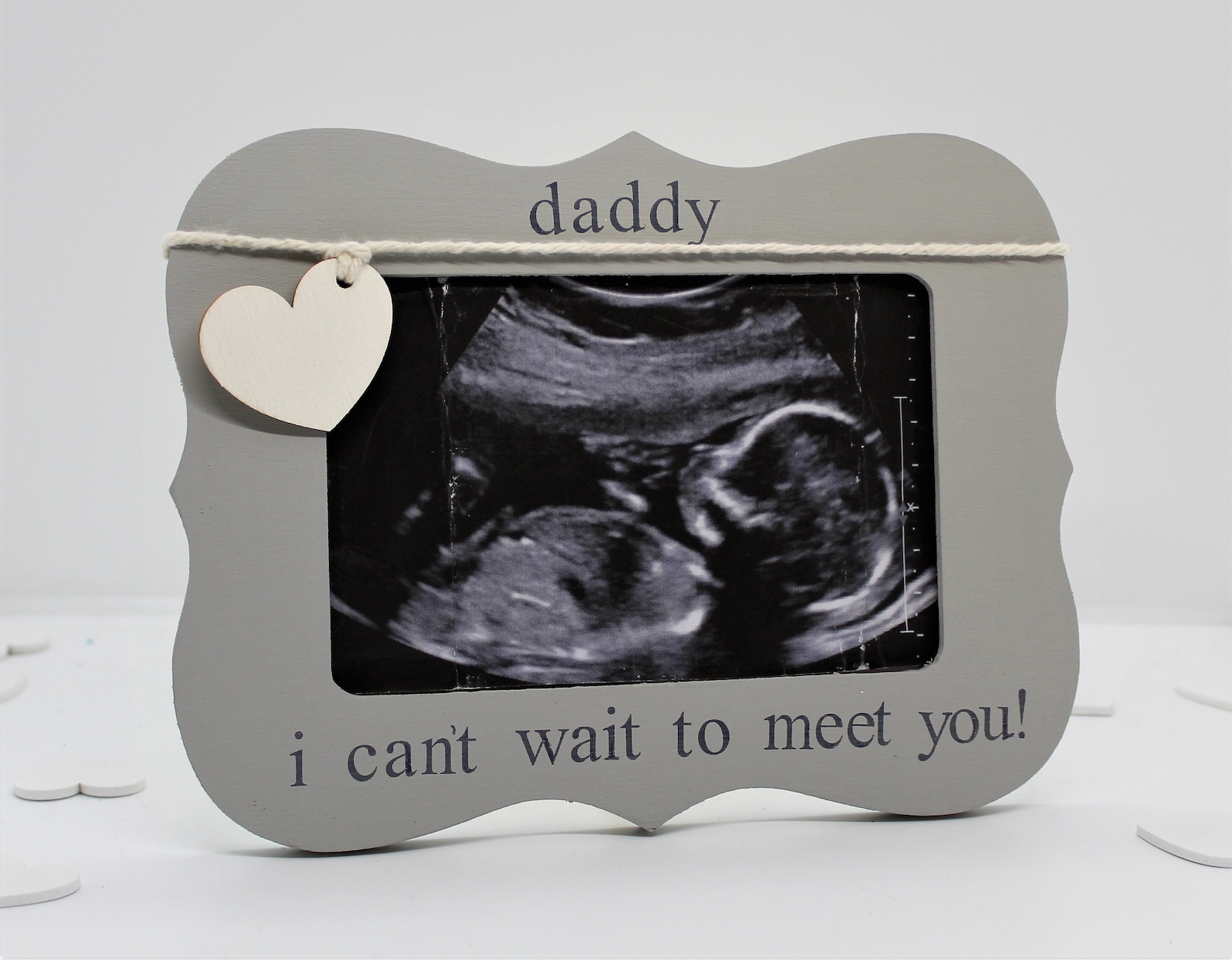 Gender Neutral Baby Gift / Baby Gift Gender Neutral Ultrasound Frame - Etsy
