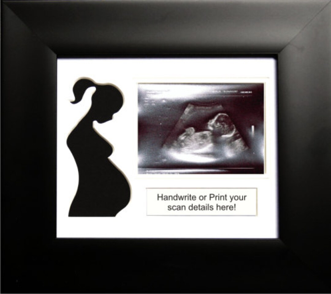 Baby Scan Sonogram Ultrasound Photo Frame 6x5" - Choose Black or White ...