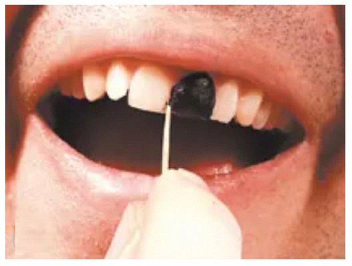 Black Tooth Wax: Theatrical Special Effects Makeup (0.125 Oz /3.5 G) - Etsy