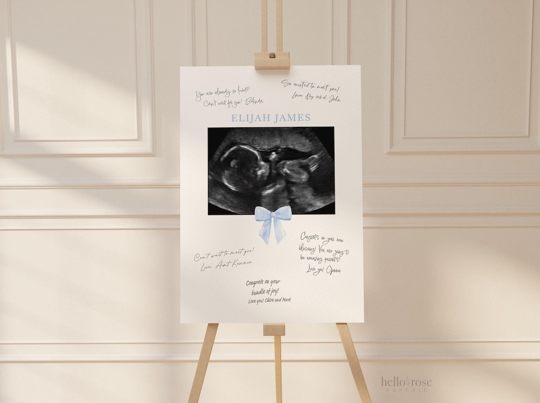 Ultrasound Guest Book Sign, Blue Bow Baby Shower, Personalized Sonogram ...