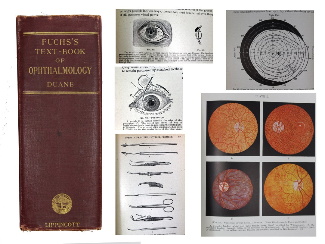 Fuch's Text Book of Ophthamology 1917 Duane Comprehensive Early Book on ...