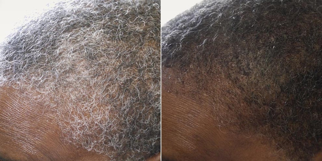 Hair Blackening Oil: Herbal Gray Hair Treatment With Amla & Henna - Etsy