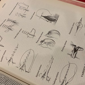 Vintage Dorland's Illustrated Medical Dictionary 1974 Twenty-fifth ...